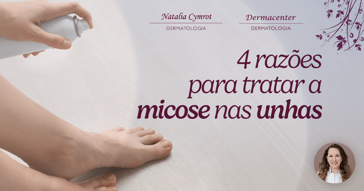 4 razões para tratar a micose nas unhas - Clínica Natalia Cymrot ...