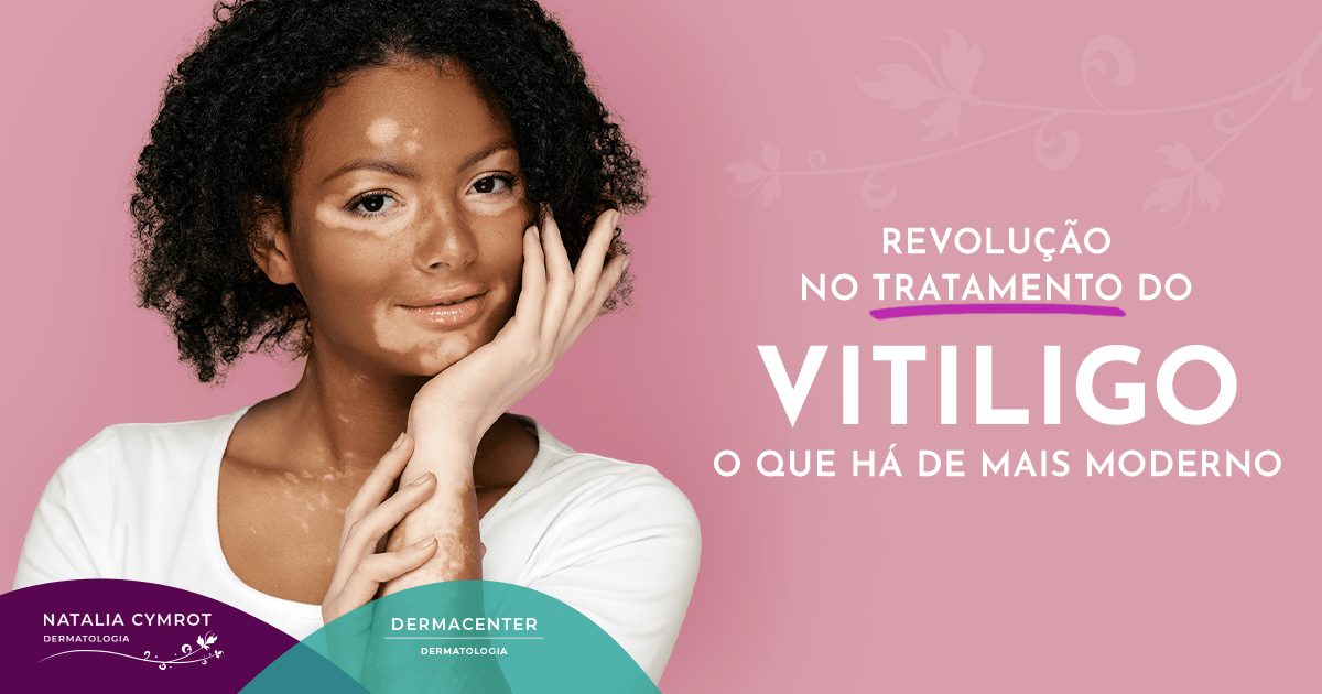 Revolução no tratamento do vitiligo: o que há de mais moderno ...