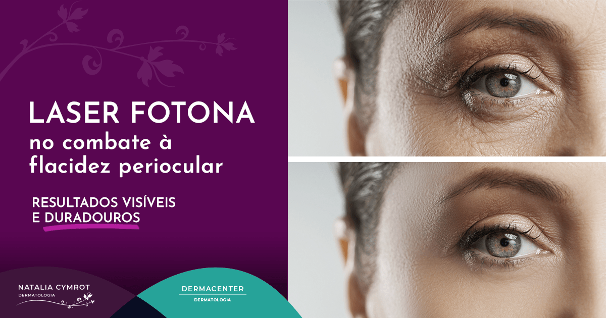 Laser Fotona no combate à flacidez periocular: resultados visíveis e ...