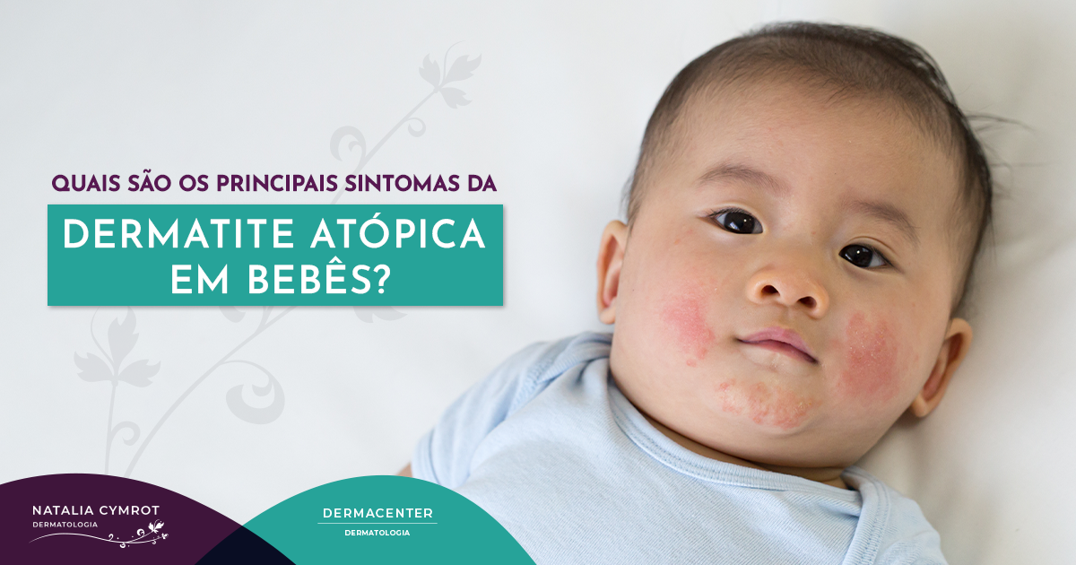 Quais são os principais sintomas da dermatite atópica em bebês ...